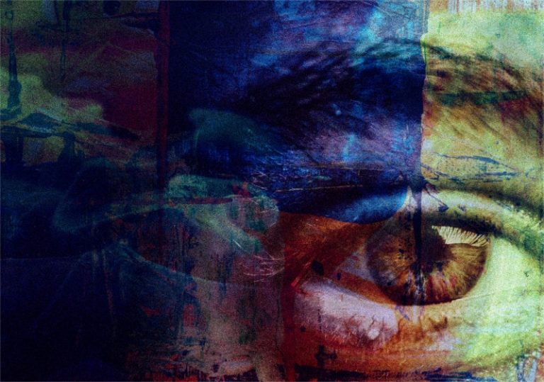 Visual Snow And Sensory Misperception - Owen White - Visual Snow Man